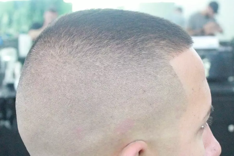 Bald Fade Haircut - Ustupující vlasová linie
